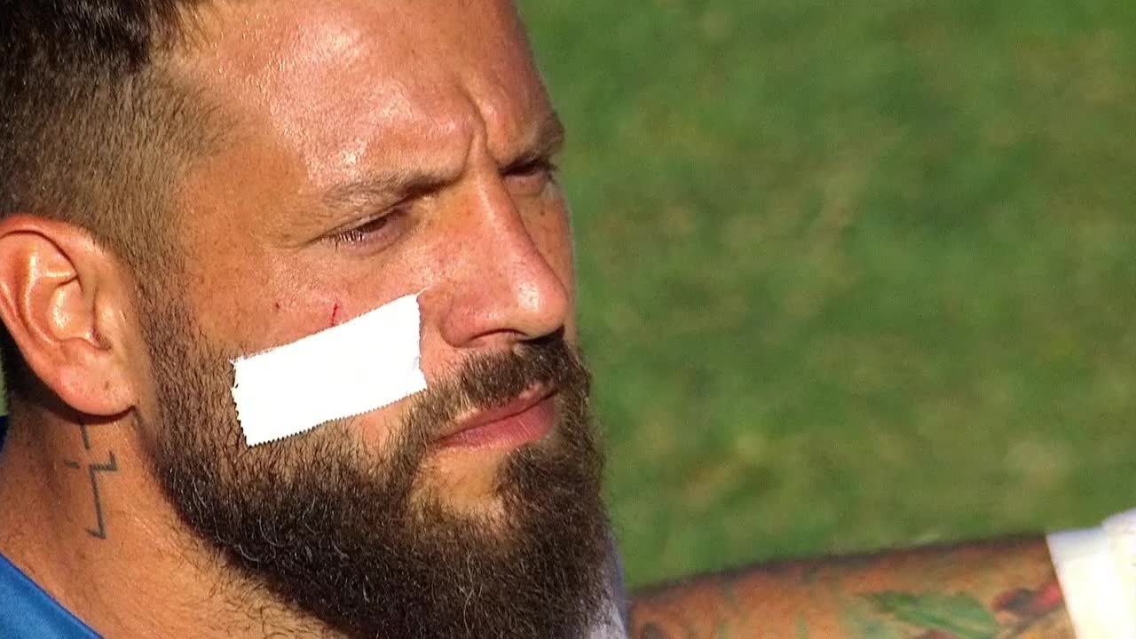 Broun sufrió un corte en la cara: “Siento que me cae una bomba en el ...